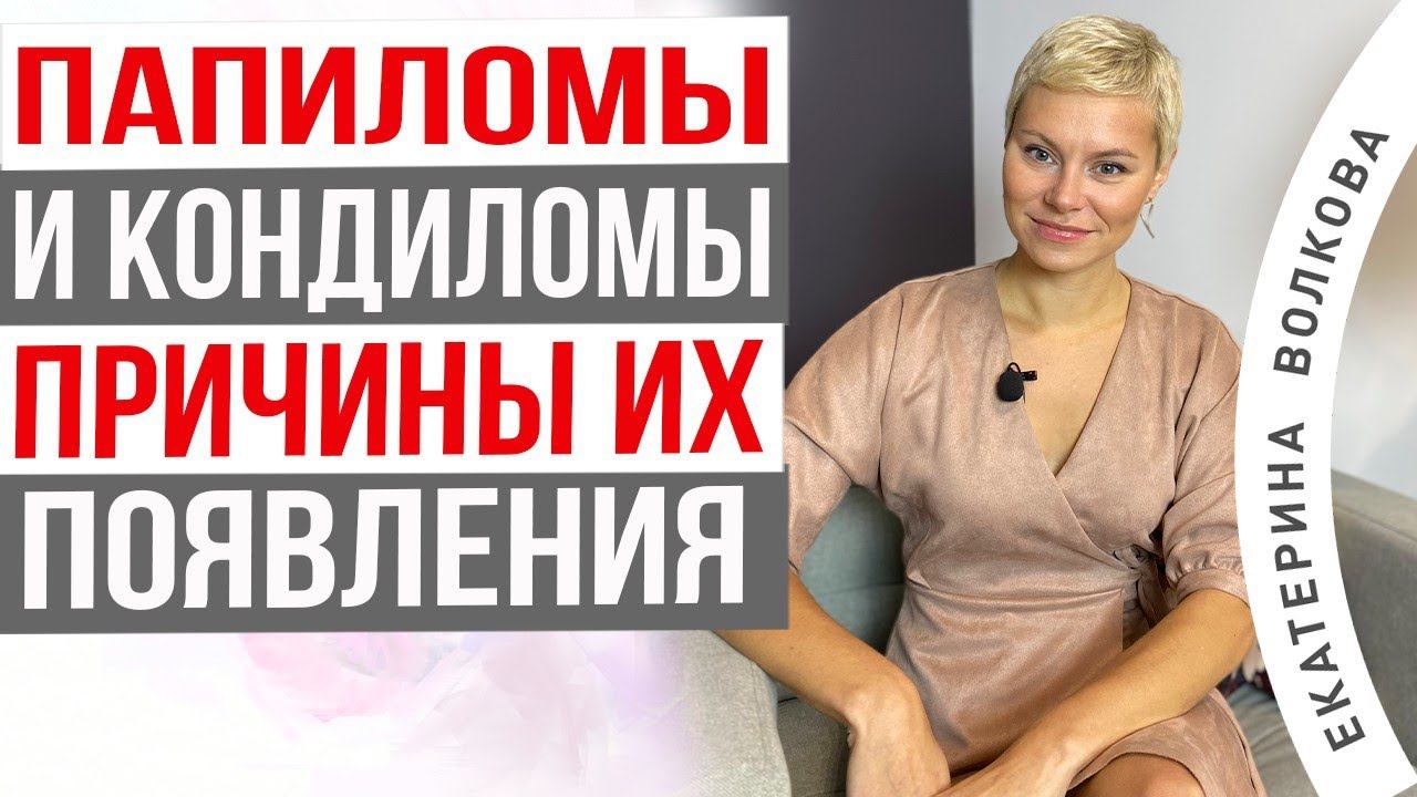ВПЧ! Что нужно знать о папилломах и кондиломах. Как можно заразиться. Врач Екатерина Волкова.