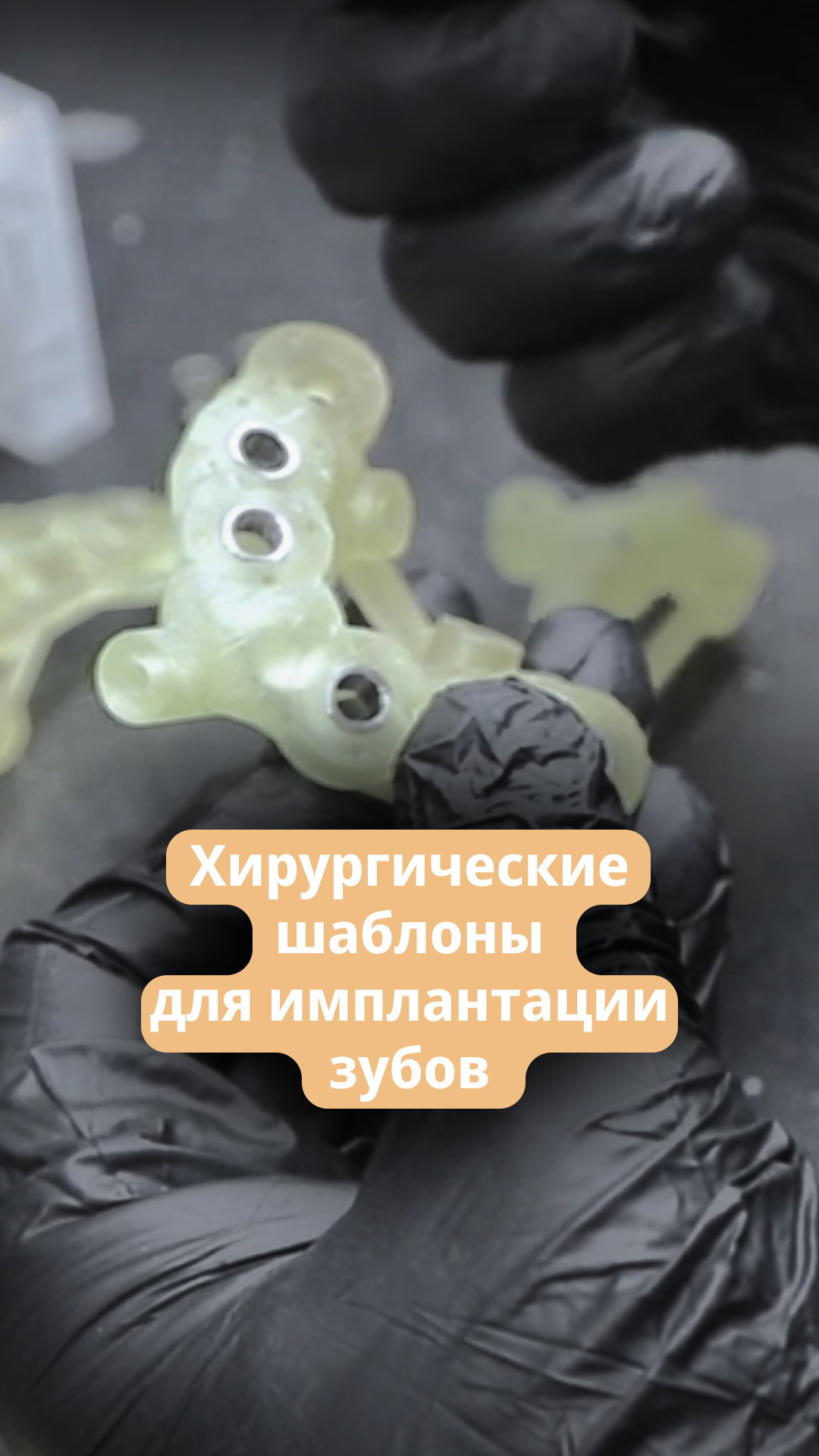 Хирургические шаблоны для имплантации зубов