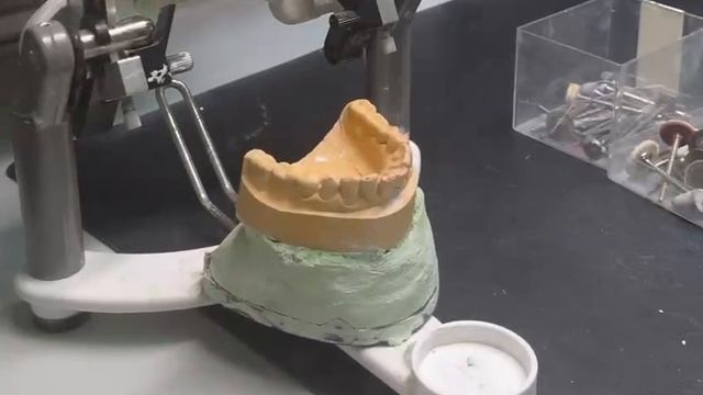 Пандент зуботехническая лаборатория