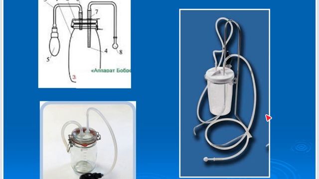 Рентгенологическое исследование толстой кишки.mp4