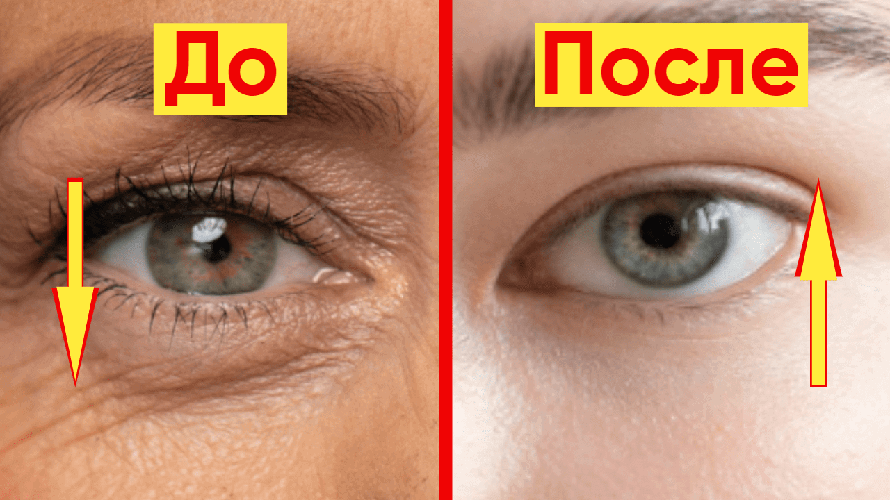 КАК ПОДНЯТЬ НАВИСШЕЕ ВЕКО И РАЗГЛАДИТЬ МОРЩИНЫ ВОКРУГ ГЛАЗ!