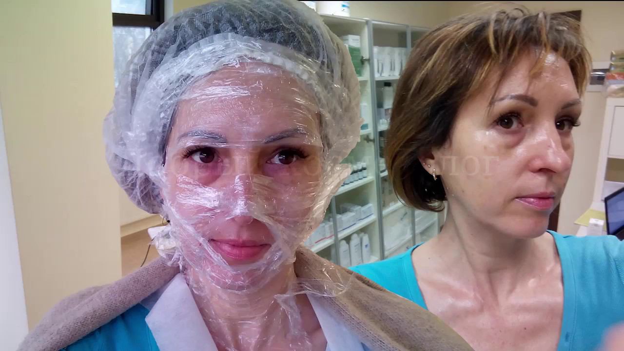 ЖЕЛТЫЙ ПИЛИНГ - процедура и шелушение день за днем | Golden Yellow Peel Dermatime