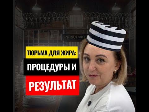 Санаторий похудения "Тюрьма для Жира": процедуры и результат