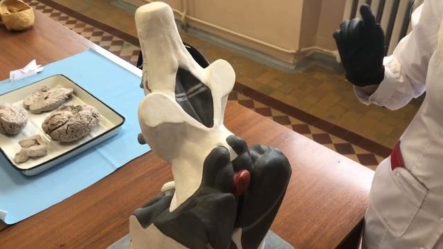 Общий обзор головного мозга, производные мозговых пузырей. Оболочки головного мо