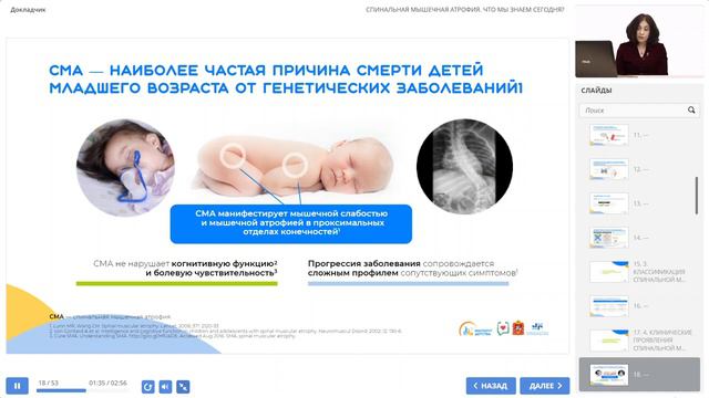 ДИОМ: Спинальная мышечная атрофия. Что мы знаем сегодня.