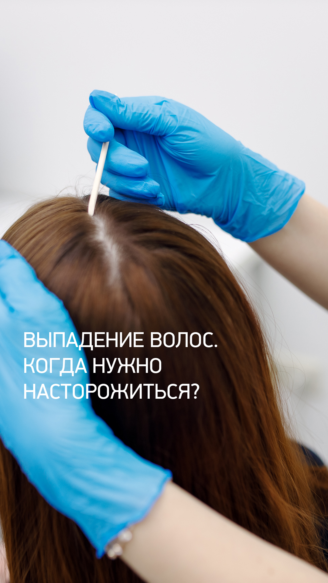 Выпадение волос. Что должно насторожить??