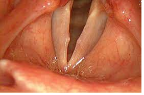 Разработка ГОЛОСОВЫХ связок.Вдох. ВЫДОХ. Клапаны Сердца.. .MP4