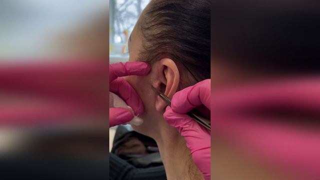 1 месяц после фейслифтинга