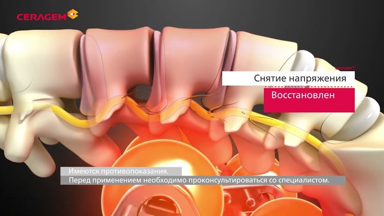 Воздействие CERAGEM Master V3 на организм человека