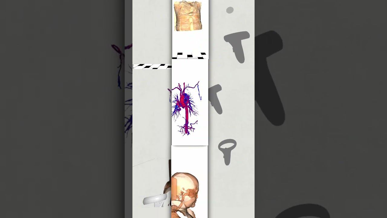 Inobitec VR DICOM Viewer: functionality overview
