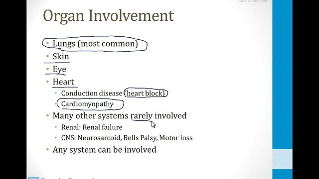 Лёгкие USMLE - 3. Иные темы - 7.Саркоидоз