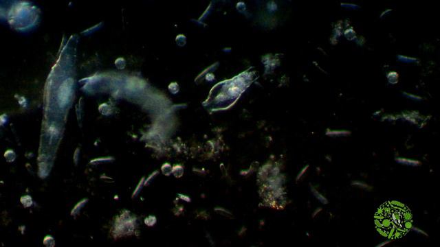 Бактерии ( прокариоты и эукариоты )