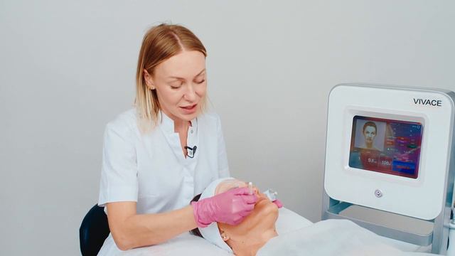 RF-лифтинг VIVACE. Кейс: Марина, 57 лет, мышечный-мелкоморщинистый тип