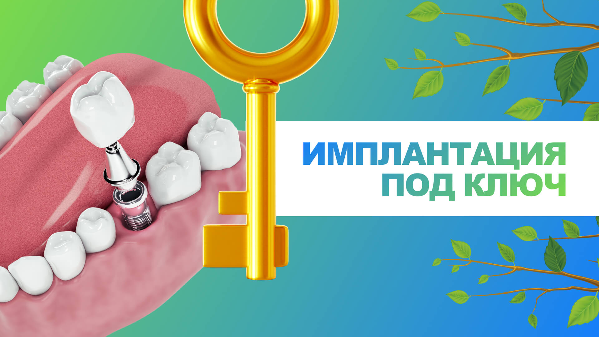 ⚡ Имплантация зубов - под ключ