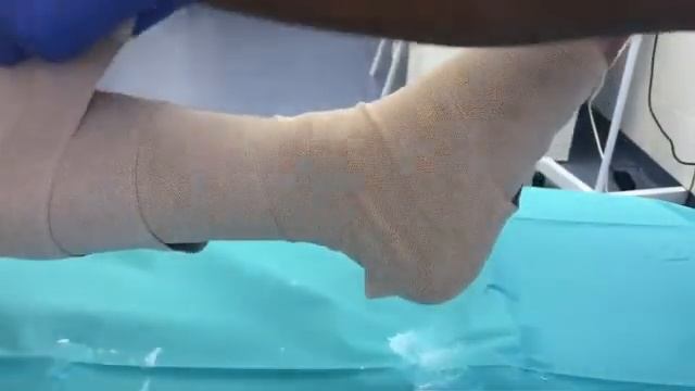 ?️ Пютербинт. Вароласт. Лечение венозной язвы.mp4