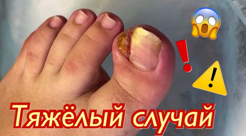 Тяжёлый случай??⚠️❗️??