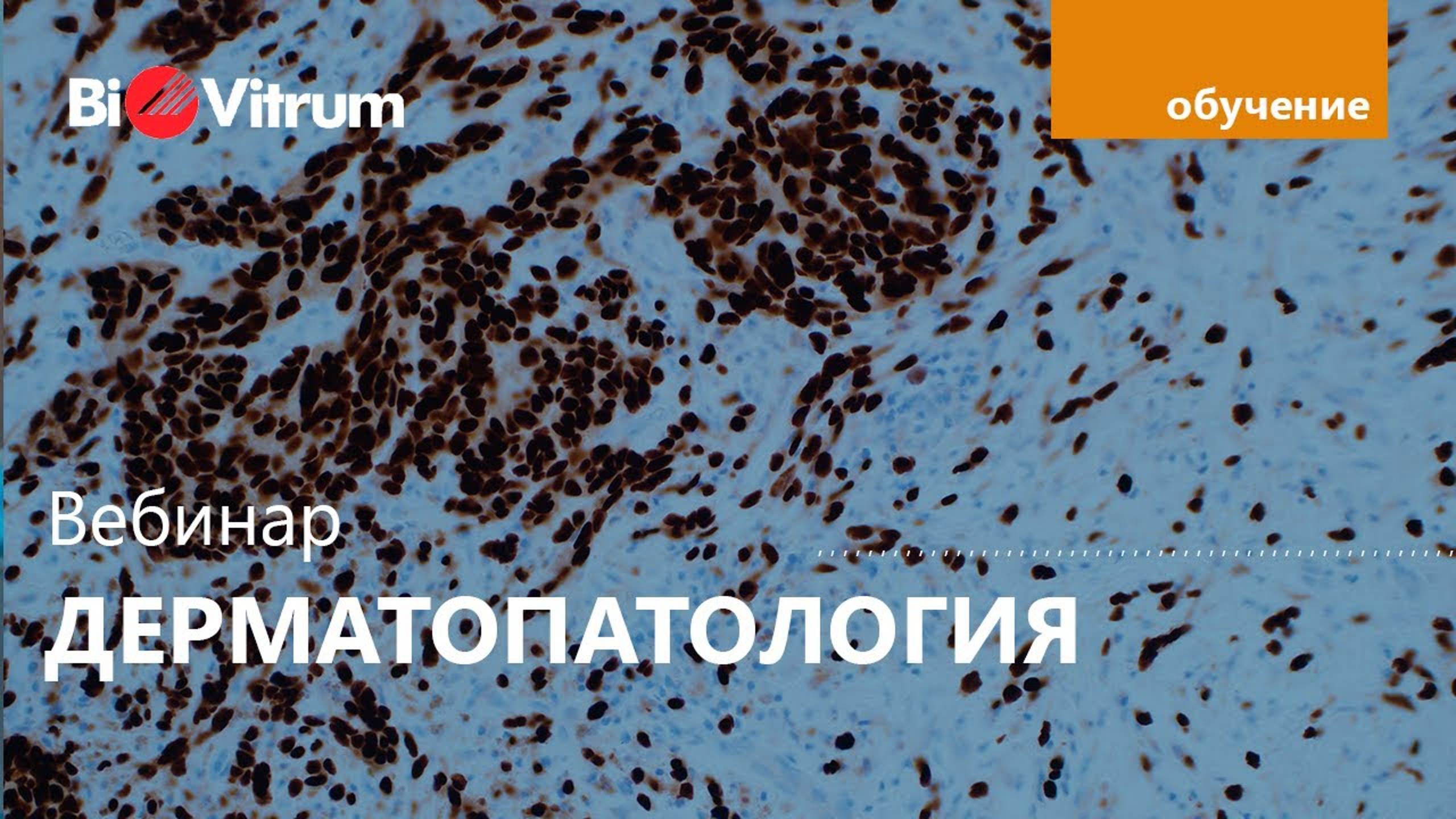 Диагностика новообразований кожи