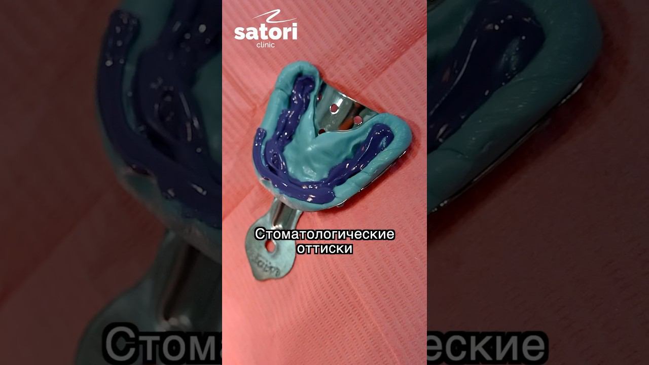 Стоматологические оттиски #зубы #стоматология #стоматологиясамара