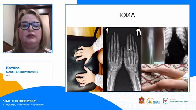 21.01.23. Час с экспертом: Педиатру о болезнях суставов. Лектор - Ю.В. Котова.
