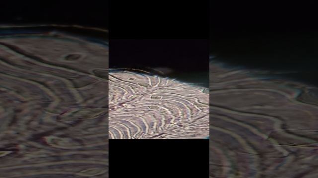 Лечение дырчатой болезни рыб под микроскопом (400)