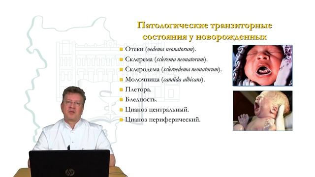 Патологические транзиторные состояния новорождённых (3)
