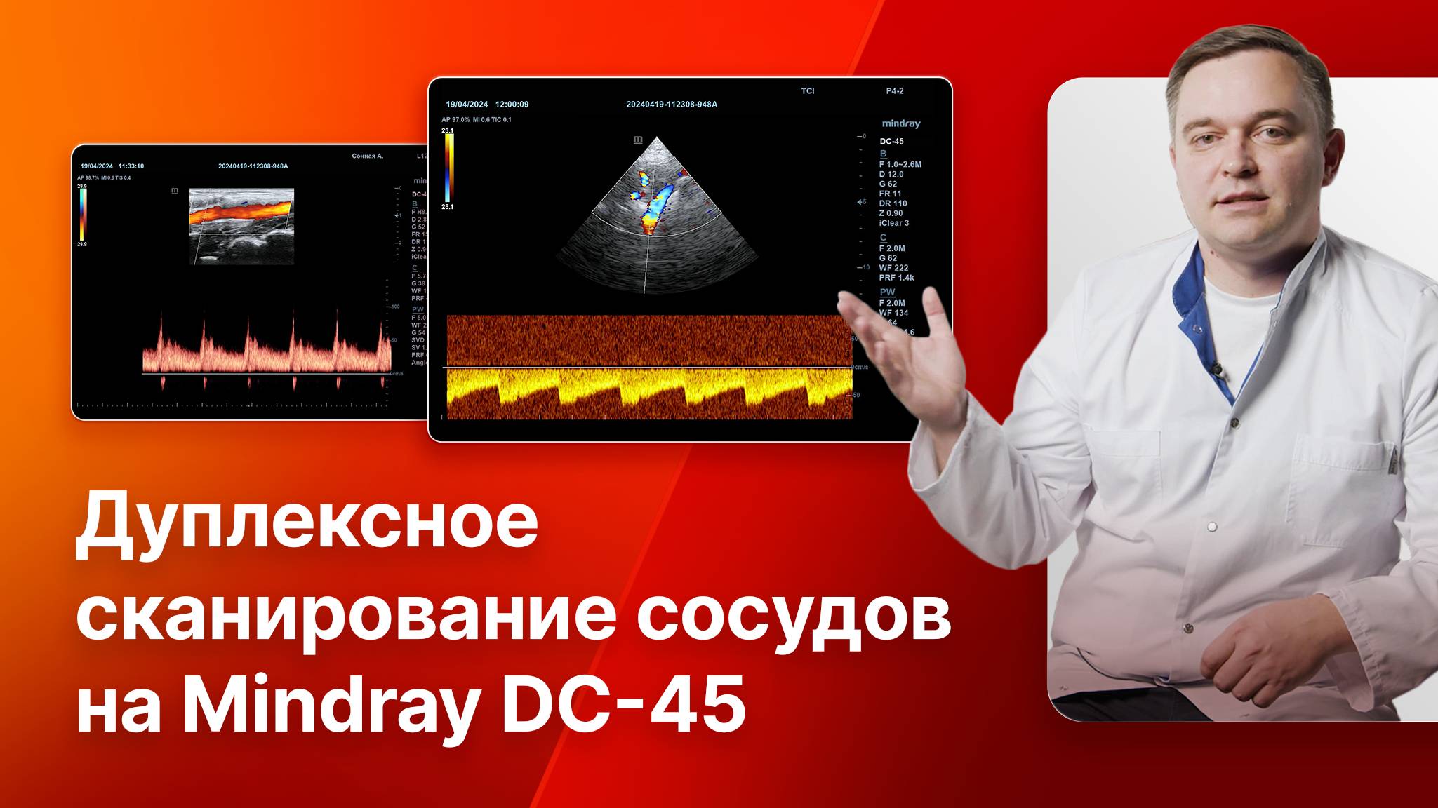 Дуплексное сканирование сосудов шеи, головного мозга, брюшной аорты и ее ветвей на Mindray DC-45