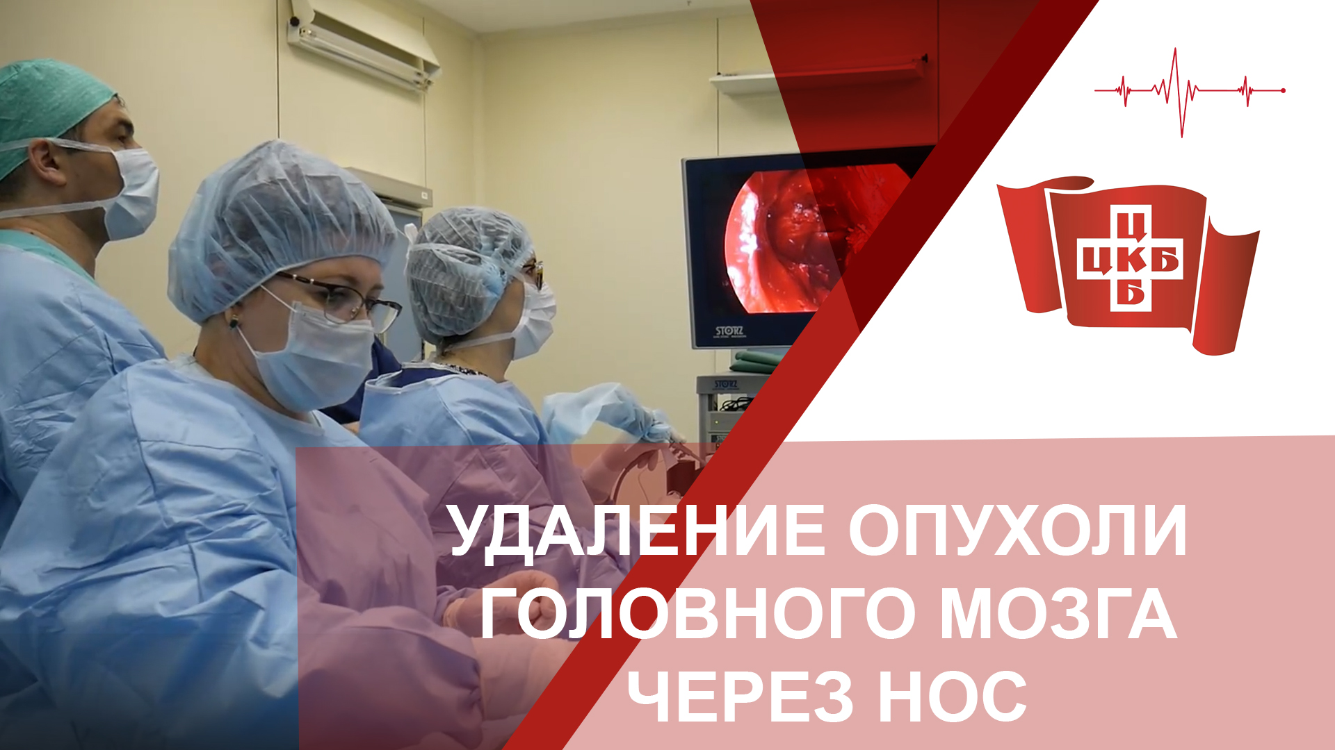 Удаление опухоли головного мозга через нос