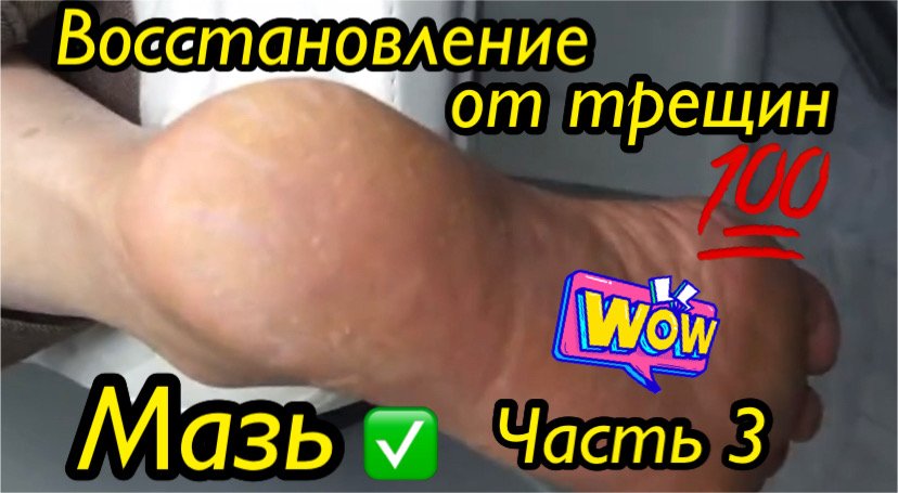 Профилактика от трещин???? • Мазь? • Часть 3