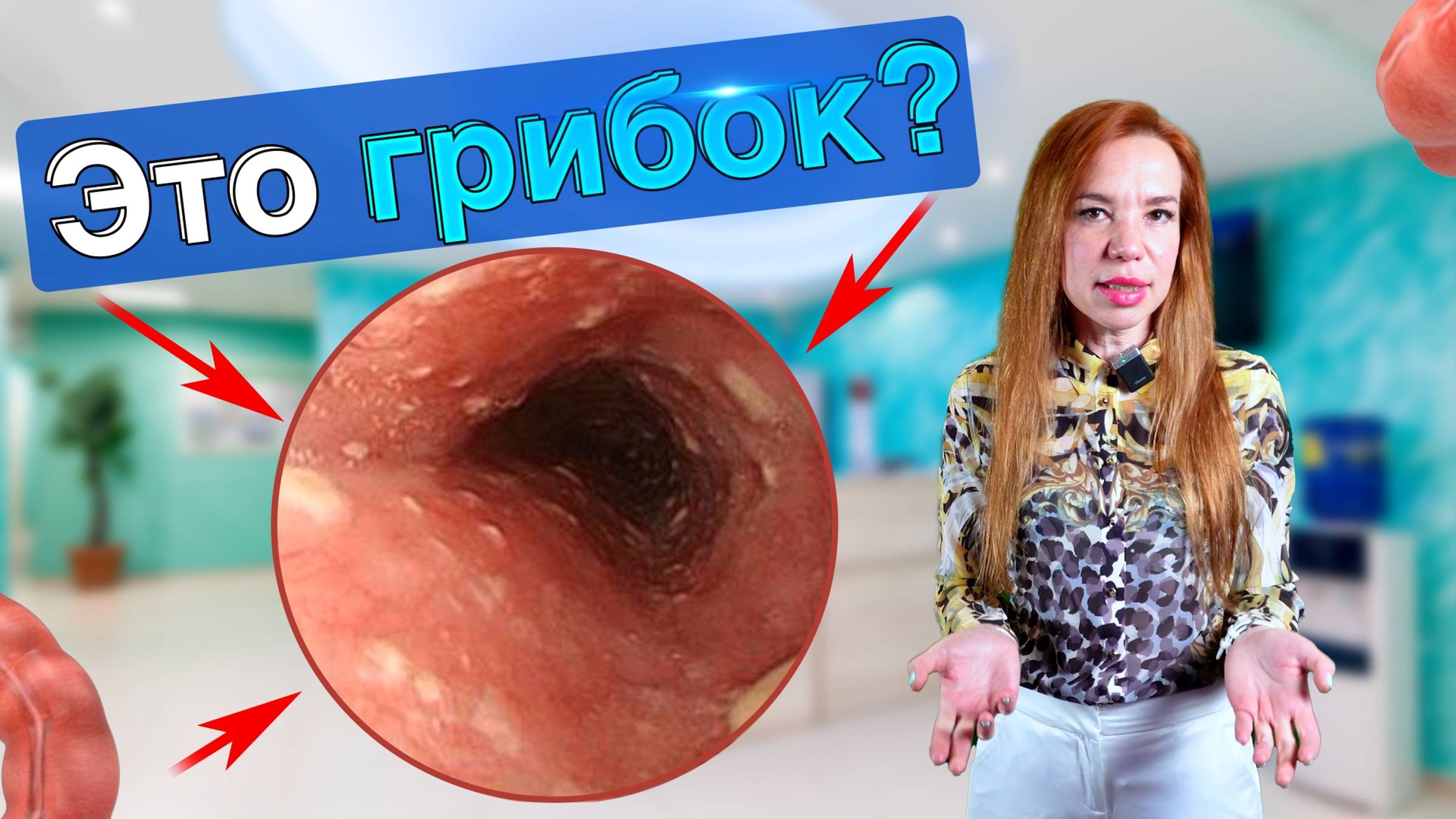 Грибок пищевода: все, что нужно знать