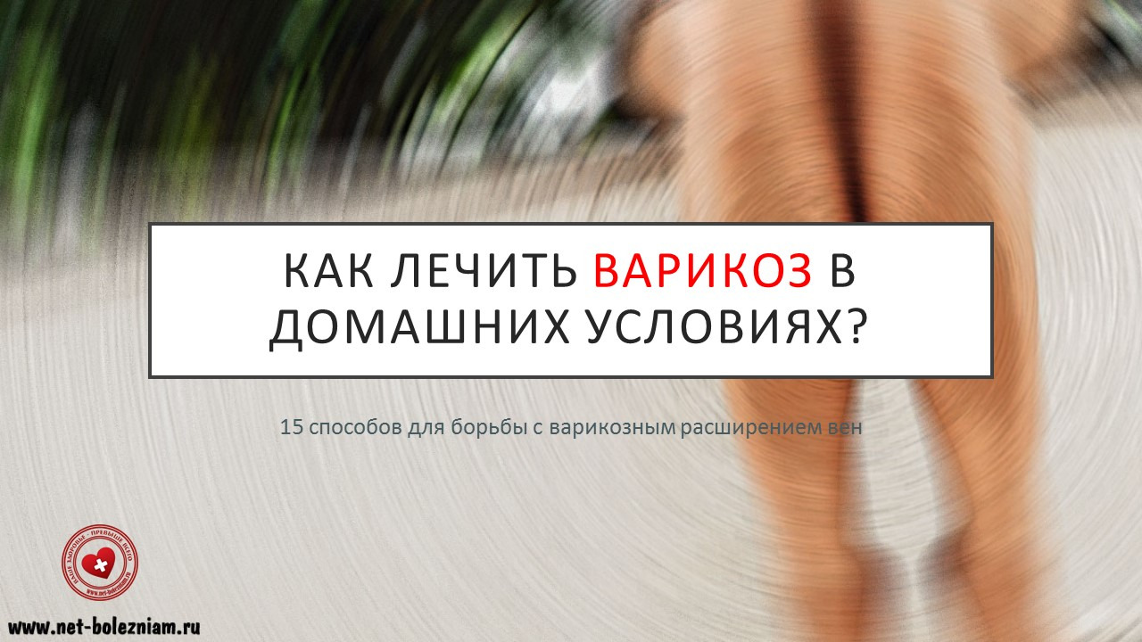 5 минут о том, как лечить варикоз в домашних условиях (видео)