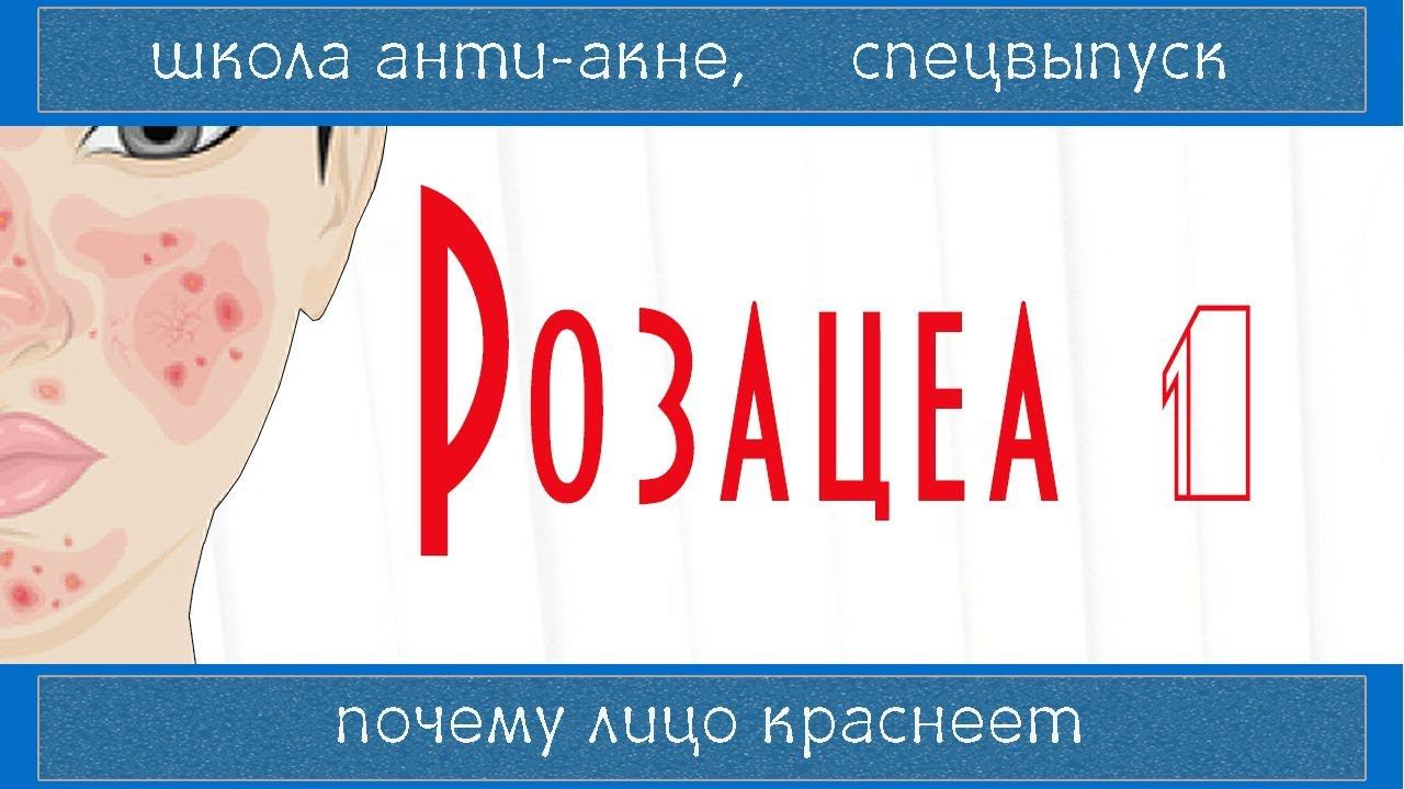 РОЗАЦЕА 1 | Rosacea | Лечится ли, причины и ошибки