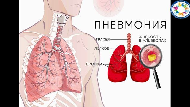 7. Профилактика заболеваний, ЛФК
