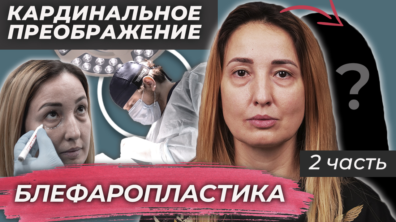Кардинальное преображение - Блефаропластика. 2 часть.