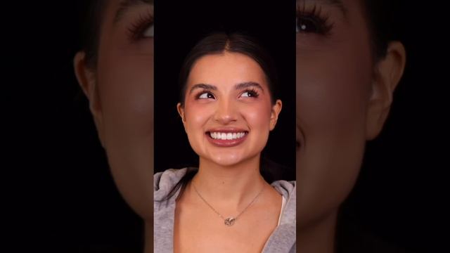 28 металлических брекетов + 1 отбеливание Zoom4🦷