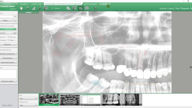Контраст и печать
