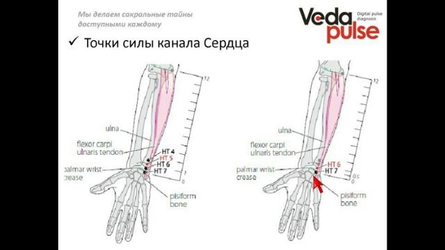 Канал Сердца, диагностика и методы воздействия