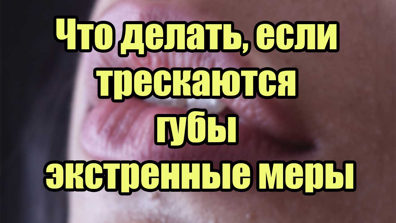 Что делать, если трескаются губы. Экстренные меры