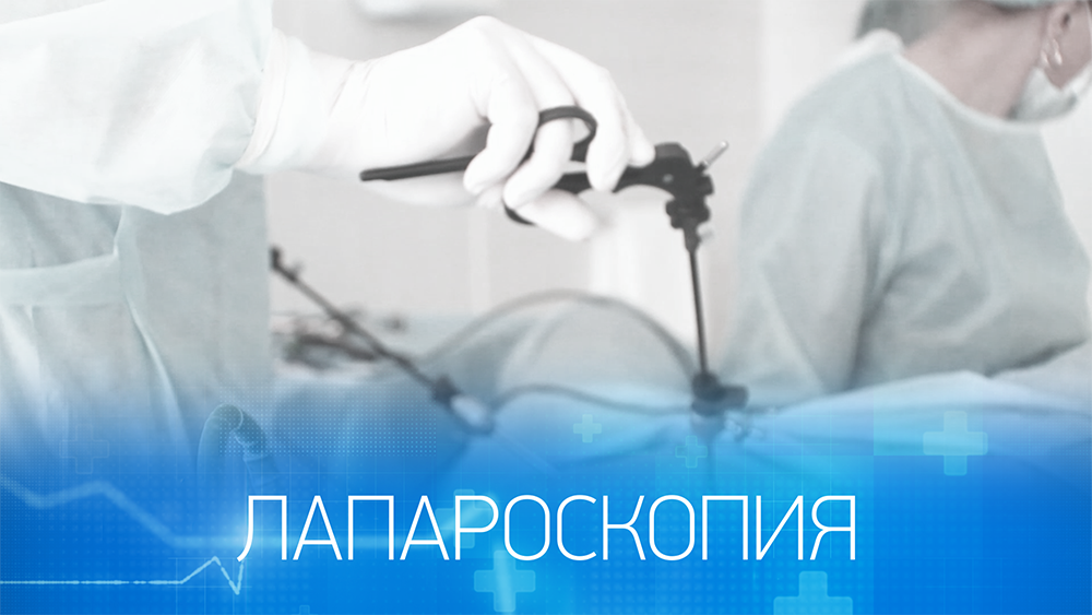 Минимальный разрез для большой операции