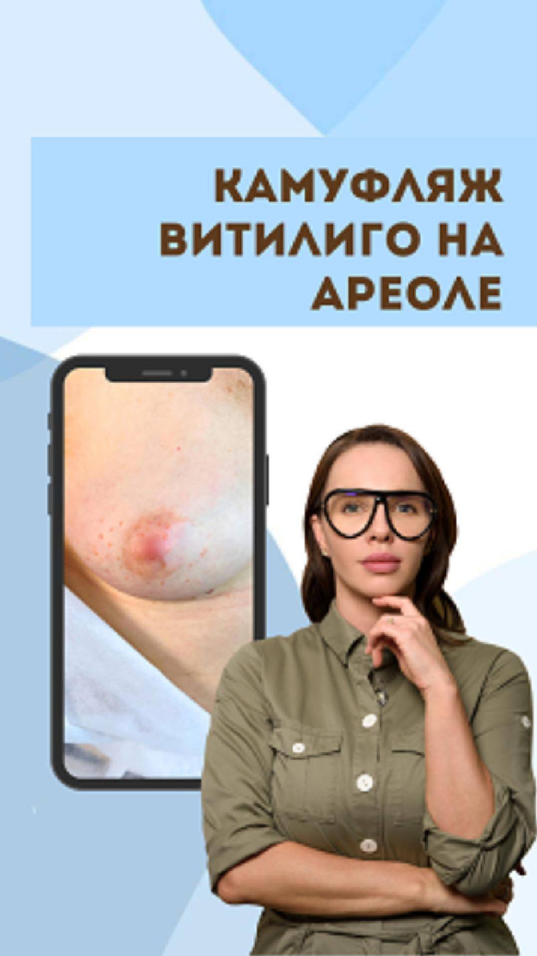 18+ | АРЕОЛА С ВИТИЛИГО. СКРЫЛИ ВИТИЛИГО ЗА 1 ВИЗИТ