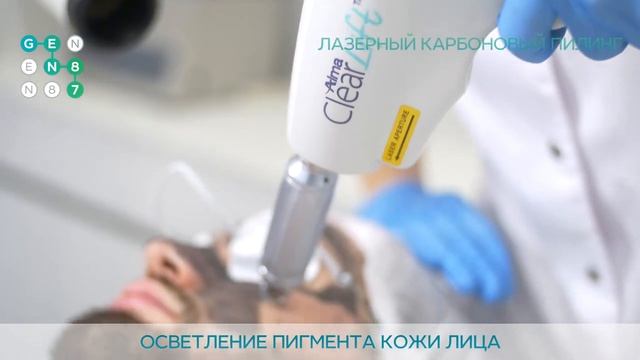 ЛАЗЕРНЫЙ КАРБОНОВЫЙ ПИЛИНГ Сеть клиник косметологии GEN87