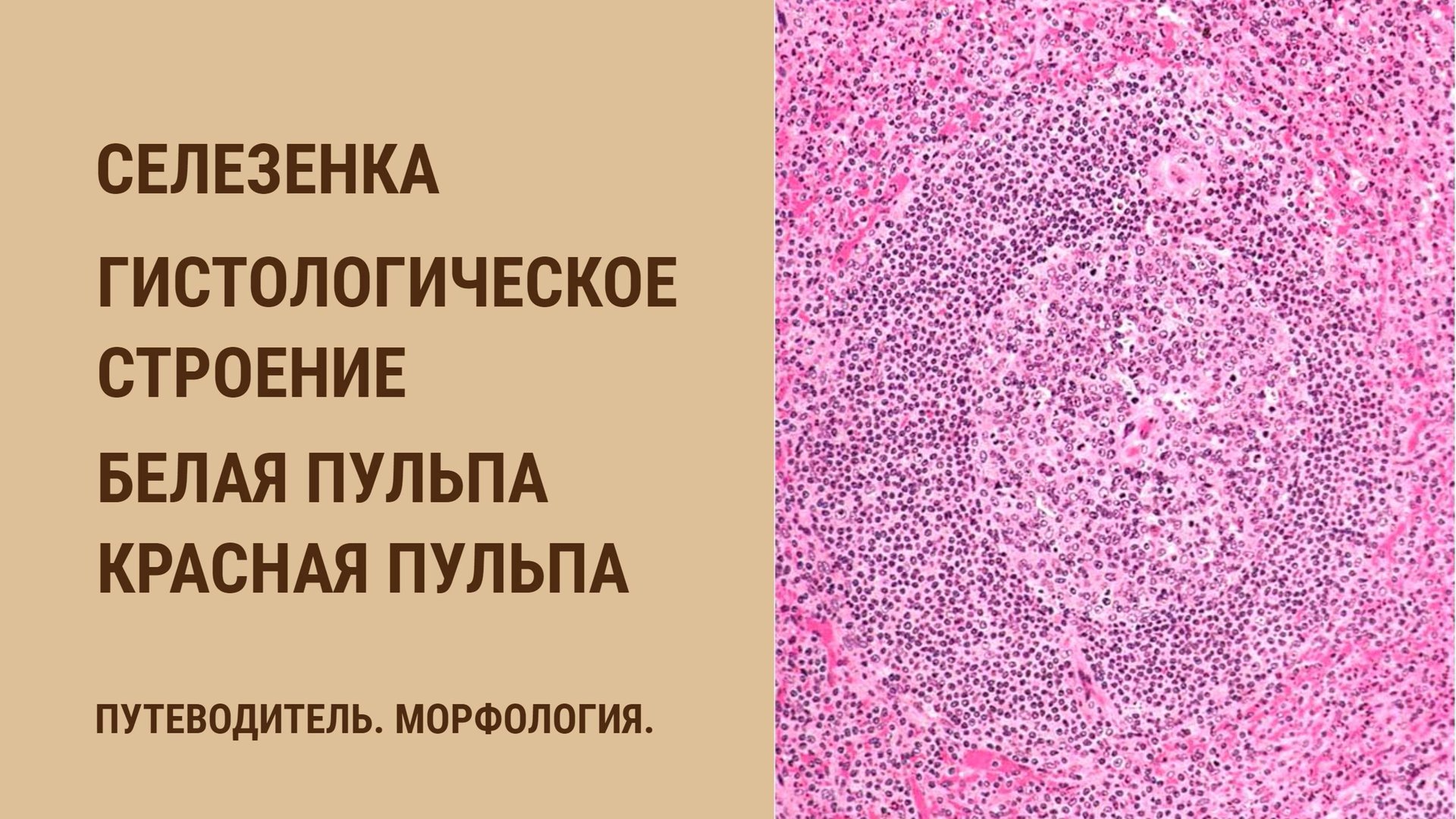 Селезенка. Гистологическое строение. Белая пульпа. Красная пульпа