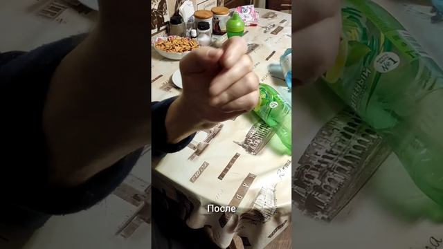 Результат от Драйнэффекта  по артрозу  кисти