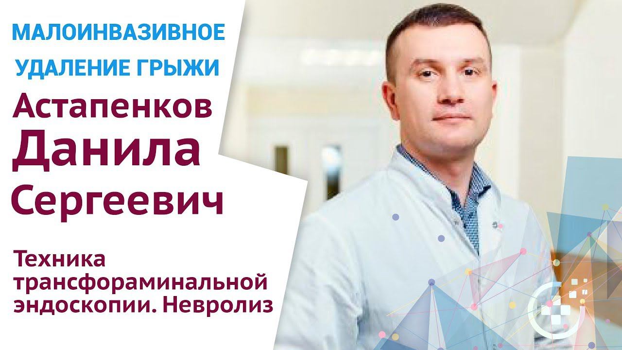 Техника трансфораминальной эндоскопии  Невролиз