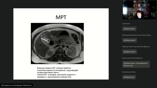 Онучина ЕВ Билиарная патология