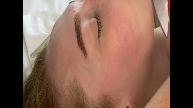 Скулы. Массаж лица. Инструментальный массаж NordBlade. Специалист: Вера Соболевская.