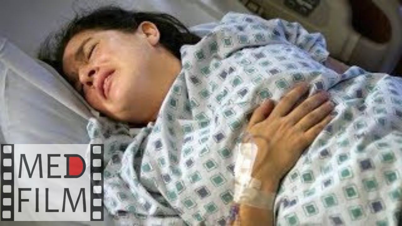 Беременность. Тяжкий токсикоз. ЭКЛАМПСИЯ © Еclampsia