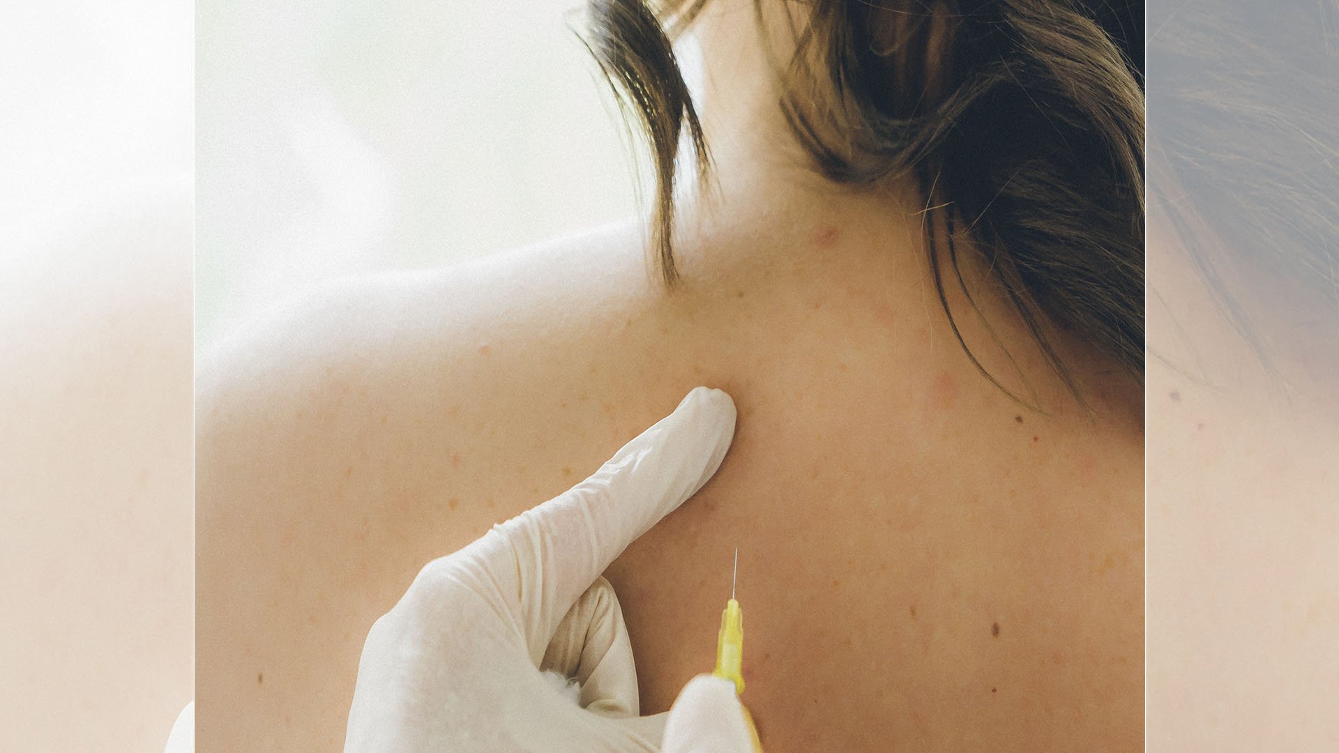 Карбокситерапия. Санаторий имени Ленина. Ундоры