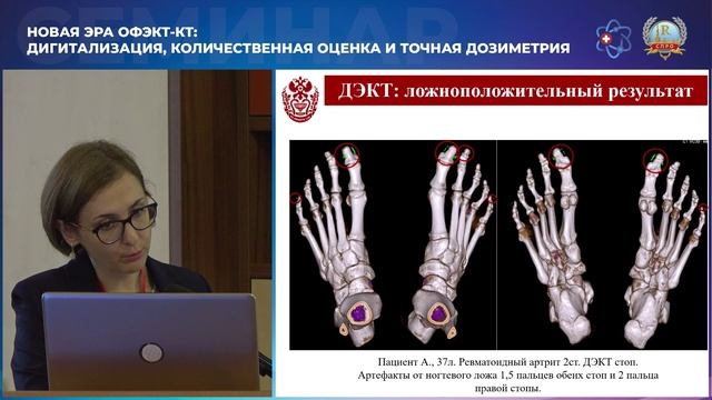 Современные возможности комплексной медицинской визуализации подагрического артрита