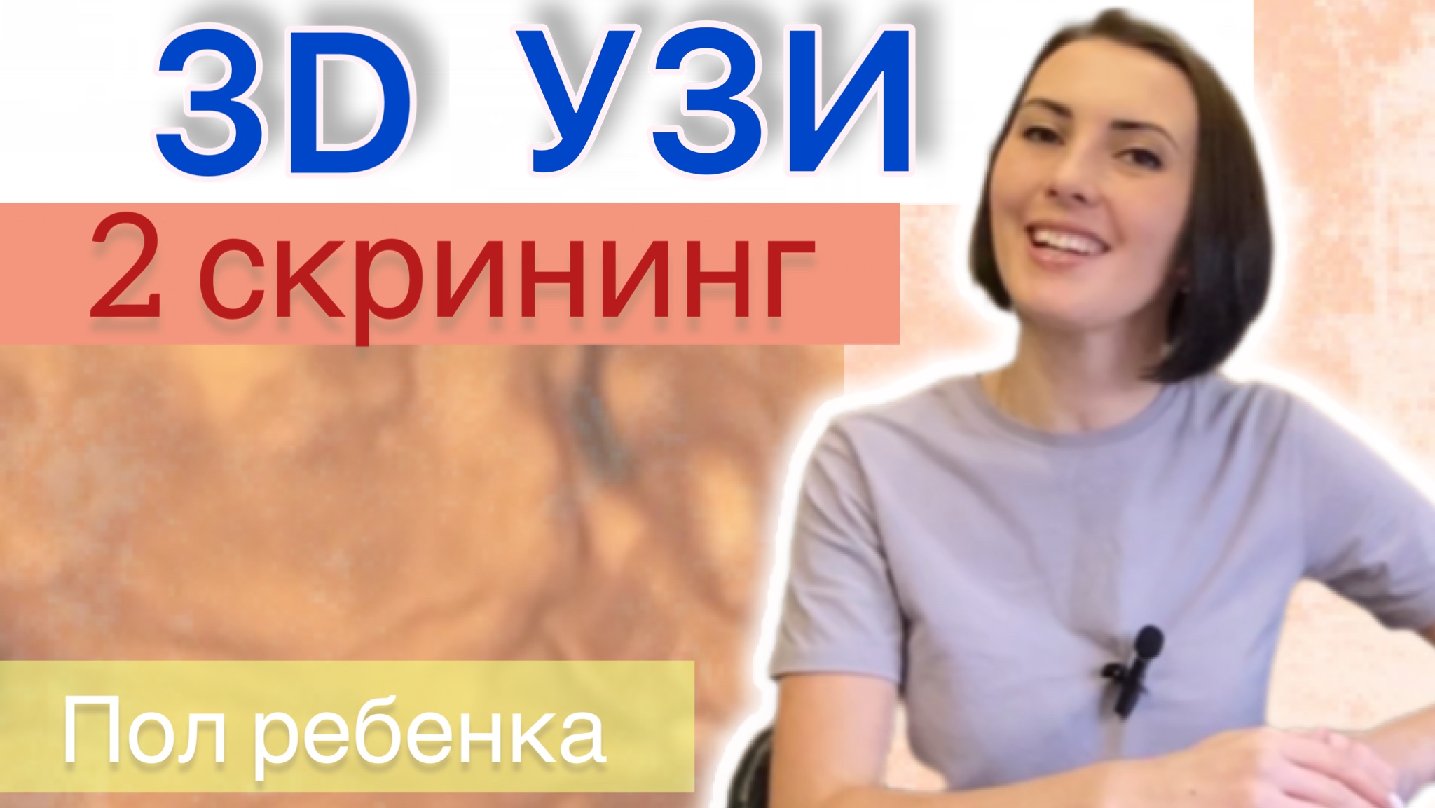 Узи второго триместра. Второй скрининг. Разбор по кадрам второго триместра?