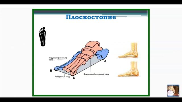 Дифференциальная диагностика суставного синдрома.mp4
